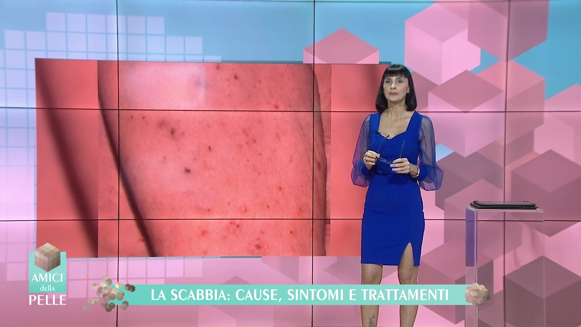 AMICI DELLA PELLE: LA SCABBIA:CAUSE,SINTOMI E TRATTAMENTI - TVL